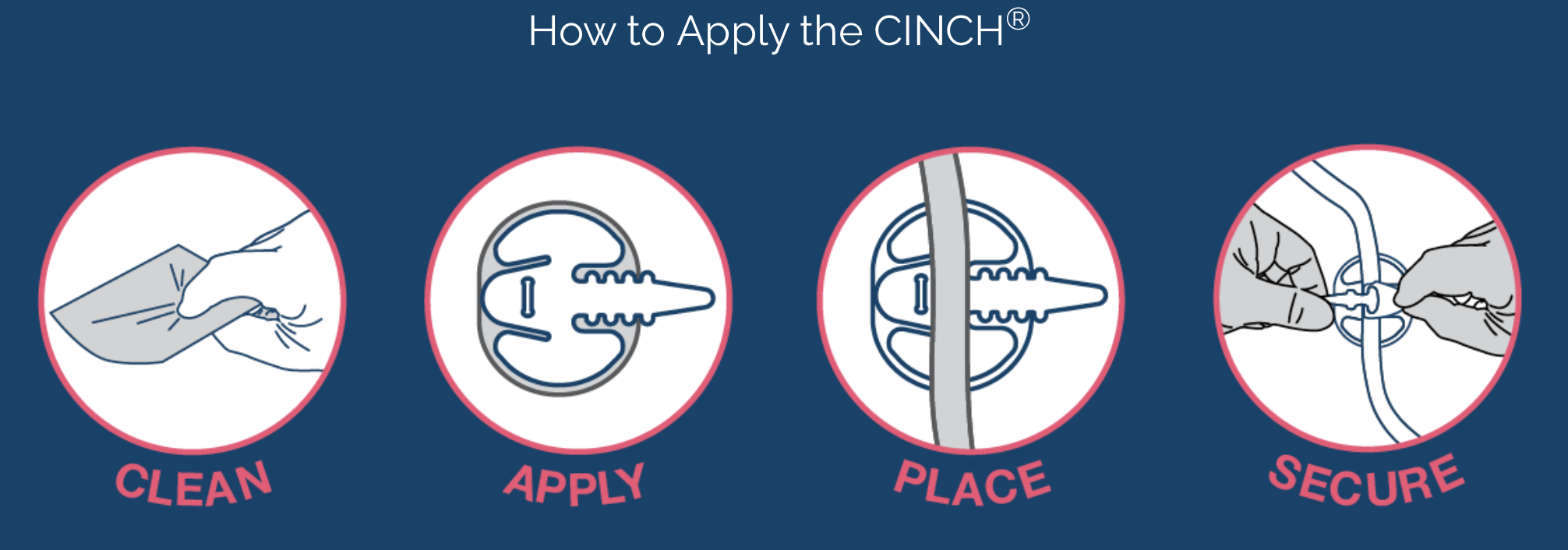 Buy AMT CINCH® | Bluestone Corporation